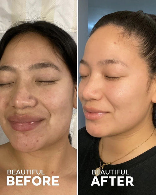 The Ultimate Guide to Choosing Your Perfect Facial: Love Letters to Yo ...